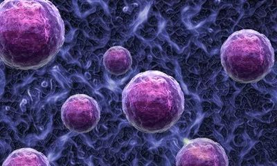 韩为东教授在STTT发表难治性B细胞淋巴瘤CAR-T疗法的5年随访结果_凤凰网健康_凤凰网