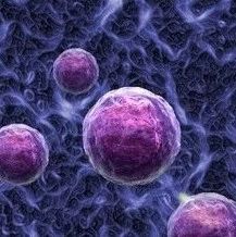 韩为东教授在STTT发表难治性B细胞淋巴瘤CAR-T疗法的5年随访结果_凤凰网健康_凤凰网